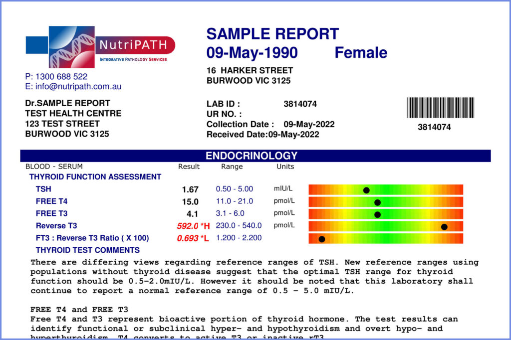 How to check your thyroid levels - laurenglucina.com